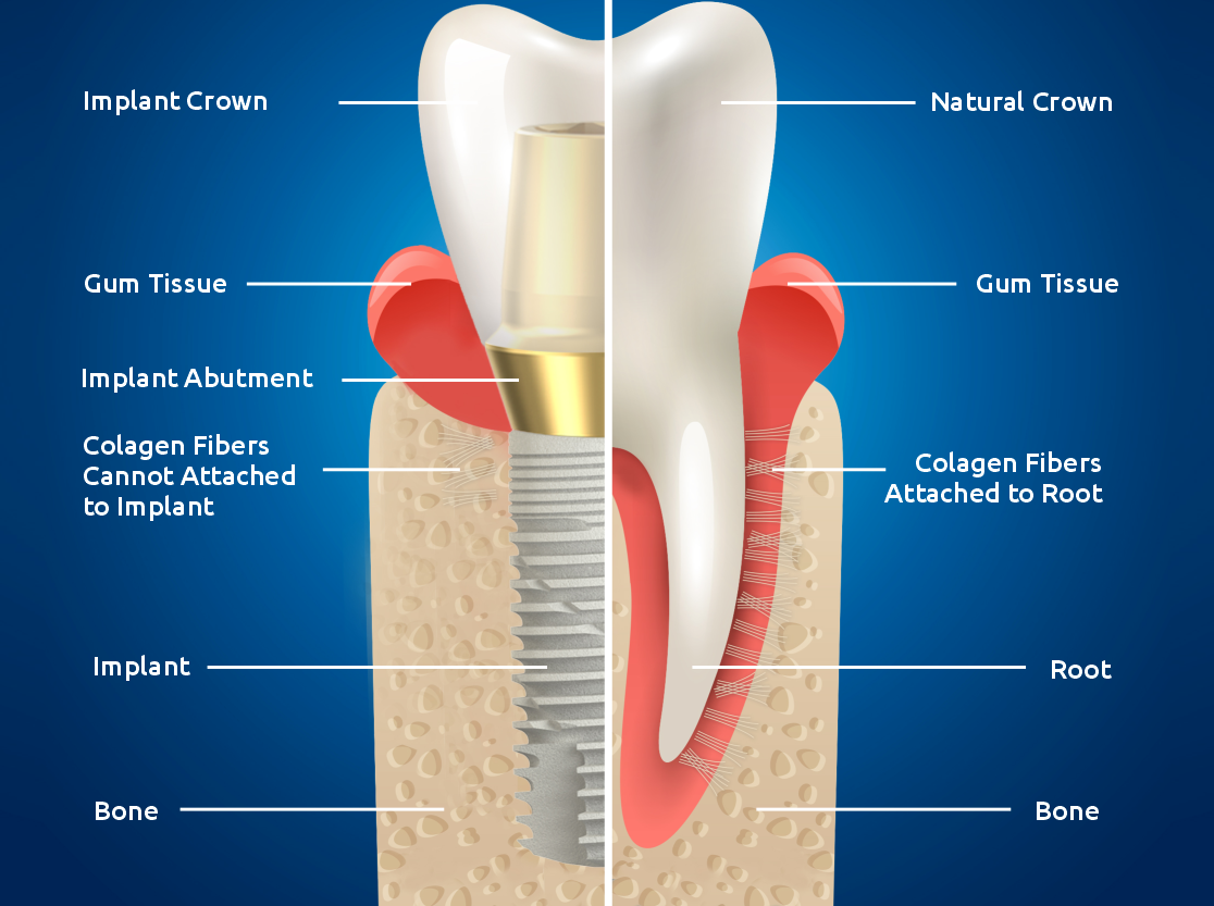 Nightguard protects your investments.