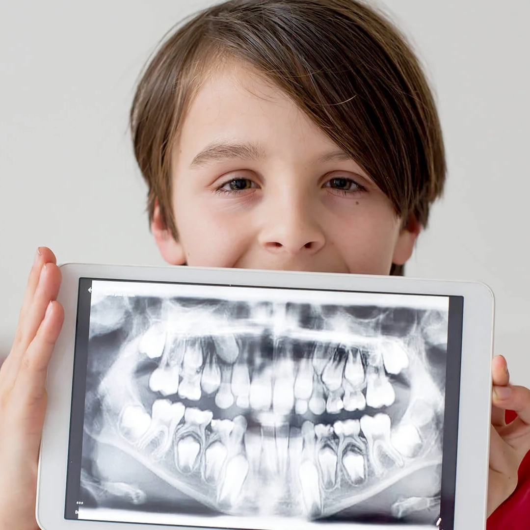 Are Dental X-Rays Safe? | Family Dentist Alhambra | Preventive Dentistry
